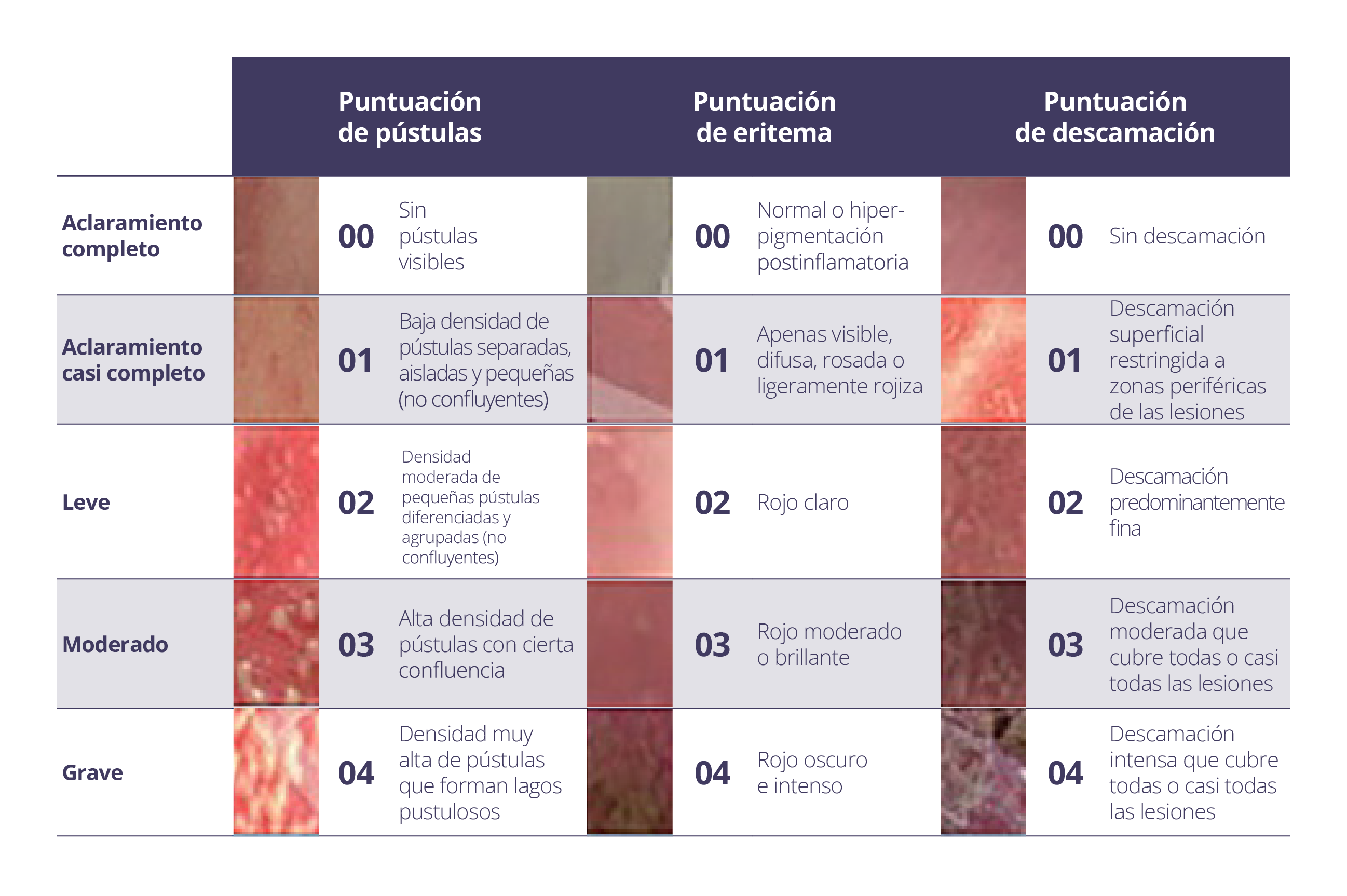 Avances en PPG | Escalas de la PPG